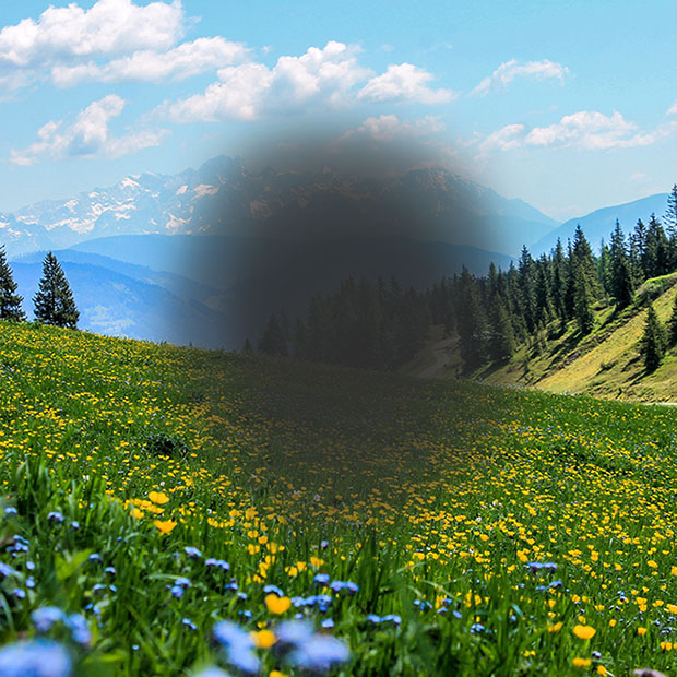 The Basics Of AMD | Vision Source Mandan